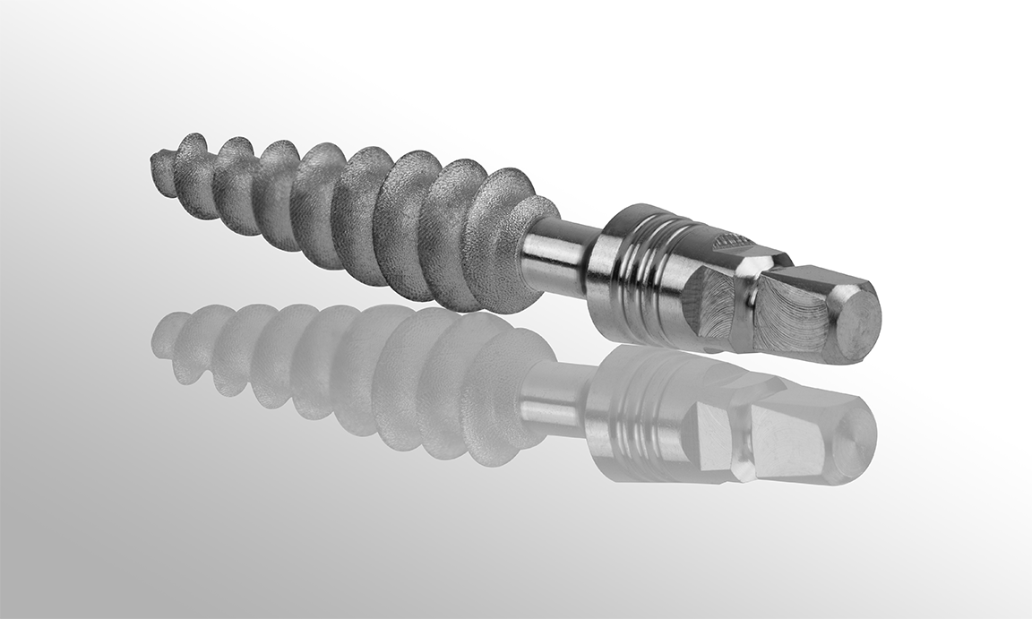 IHDE implants – Dr. Kelemen Péter